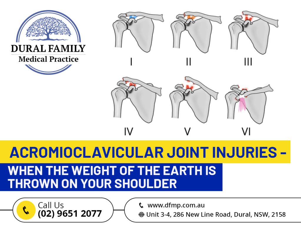 Acromioclavicular Joint Injuries – When the weight of the Earth is ...
